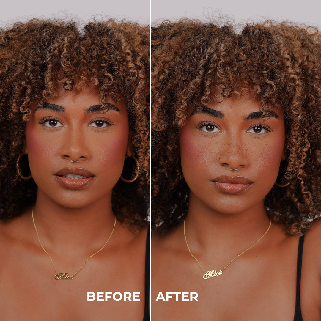 Freckle Floret™ | Trigwell Cosmetics